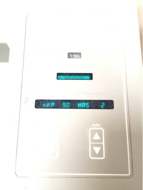GE AMX4 Plus Portable X-Ray System - Alternup Medical