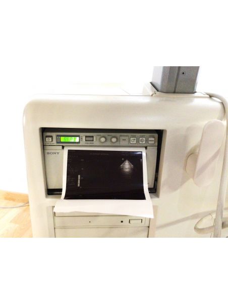 Philips HD11 XE Cardiac Ultrasound - Alternup Medical