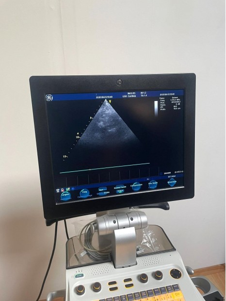 GE Vivid S6 Cardiac Ultrasound - Alternup Medical
