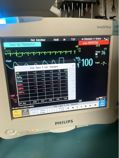 Philips Intellivue MP50 Vital Signs Monitor - Alternup Medical