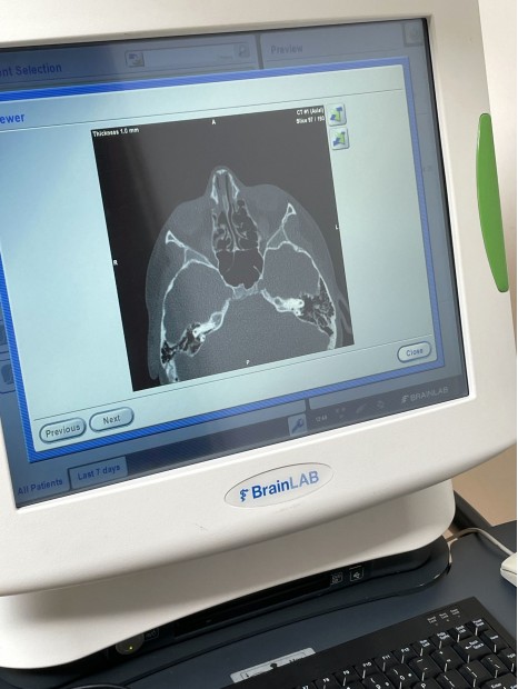 Brainlab Kolibri Surgical Navigation System - Alternup Medical