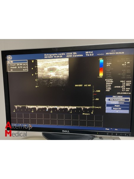 Echographe Cardiaque GE Vivid 7 Dimension - Alternup Medical