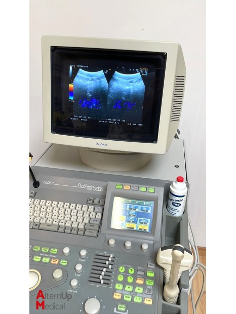 Aloka Prosound SSD-5000 Ultrasound Machine - Alternup Medical