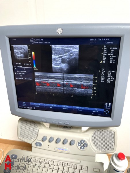GE Logiq P5 Ultrasound - Alternup Medical