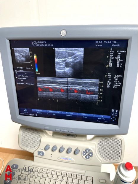 GE Logiq P5 Ultrasound - Alternup Medical