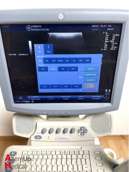 GE Logiq P5 Ultrasound - Alternup Medical