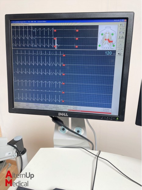GE Stress Test Station with E-Bike and Spirometer - Alternup Medical
