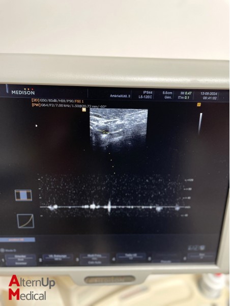 Medison Sonoace X8 Ultrasound System - Alternup Medical