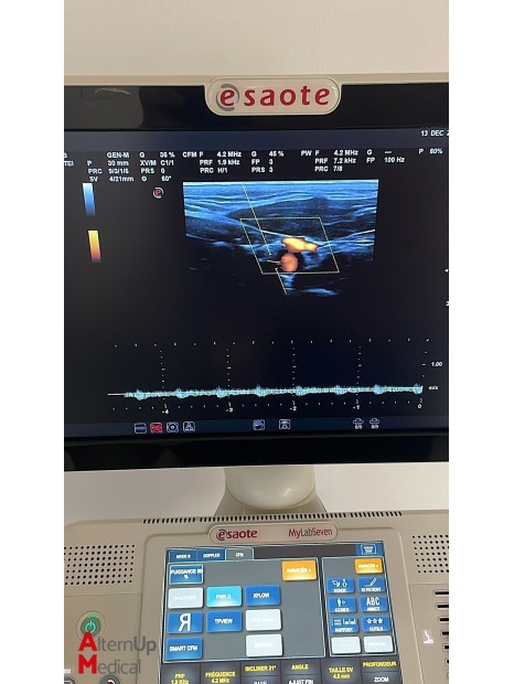 Esaote MyLab Seven eHD Ultrasound System 4 probes - Alternup Medical