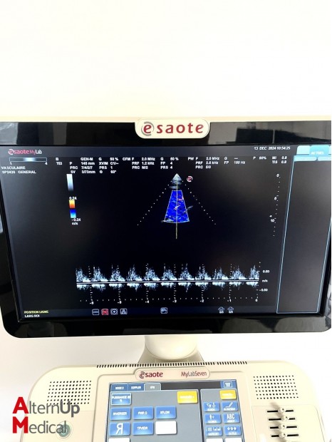 Esaote MyLab Seven eHD Ultrasound System 4 probes - Alternup Medical