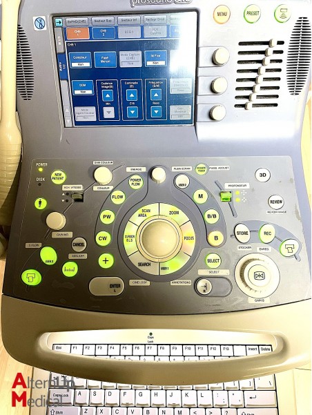 Aloka Prosound Alpha 10 Ultrasound Obst/Gyn - Alternup Medical