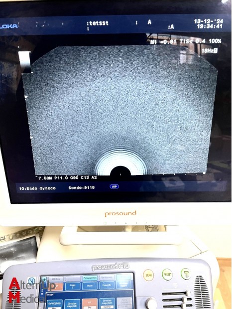 Aloka Prosound Alpha 10 Ultrasound Obst/Gyn - Alternup Medical