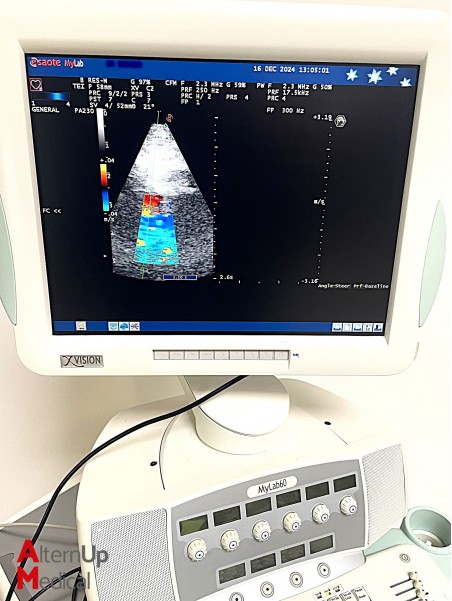 Echographe Esaote MyLab 60 Spécialité Cardiologie - Alternup Medical