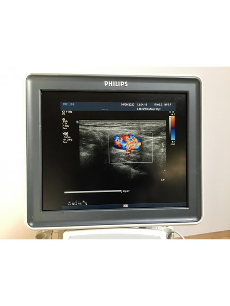 Philips iU22 Ultrasound - Alternup Medical