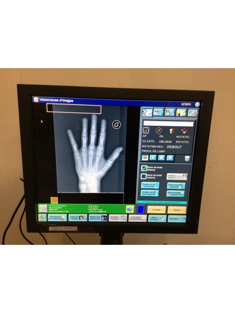 Système radiographie Carestream DirectView Elite CR-Alternup Medical