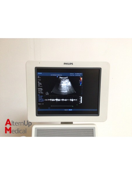 Philips HD15 Ultrasound - Alternup Medical