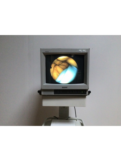 Biodigital CA2 Endoscopy System - Alternup Medical